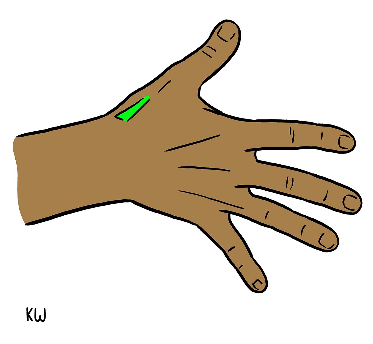 GET A GRIP!: Don't Injure Your Anatomical Snuff Box!